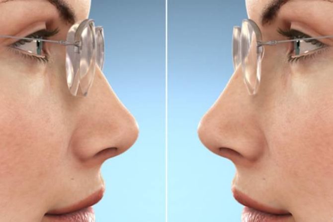 How to Order the Perfect Prescription Lenses for Your Glasses at ...