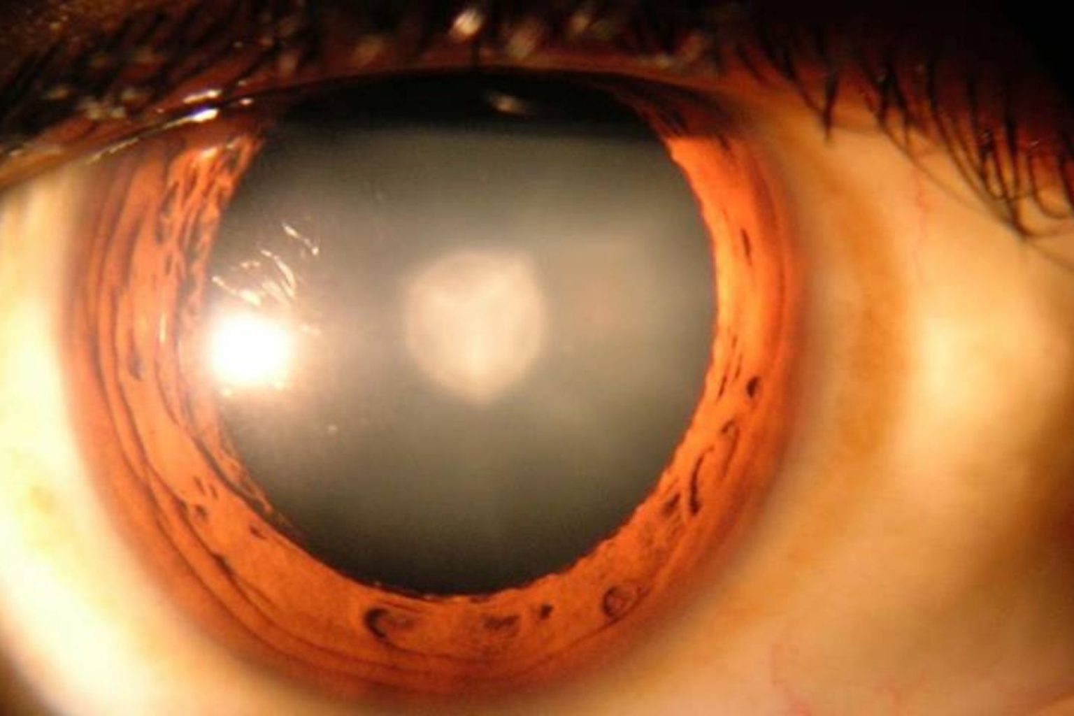 How Does Alcohol Affect Vision? What to Know | EZOnTheEyes