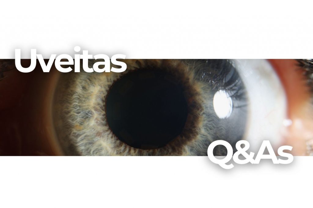 Is Uveitis Easy to Treat? (And Other FAQs) | EZOnTheEyes