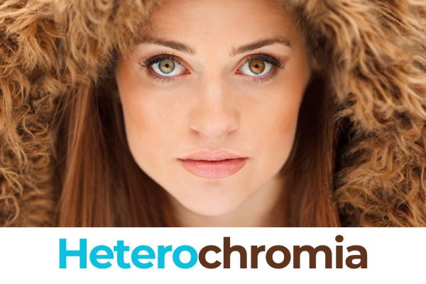 Heterochromia: The Mystery of Different Colored Eyes | EZOnTheEyes