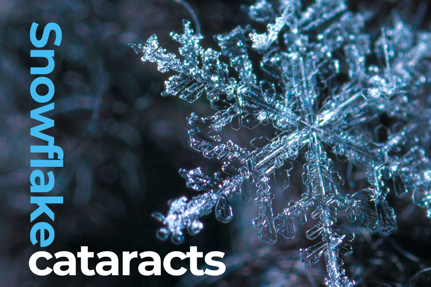 Snowflake Cataracts: An Exploration of the Mysterious Condition ...