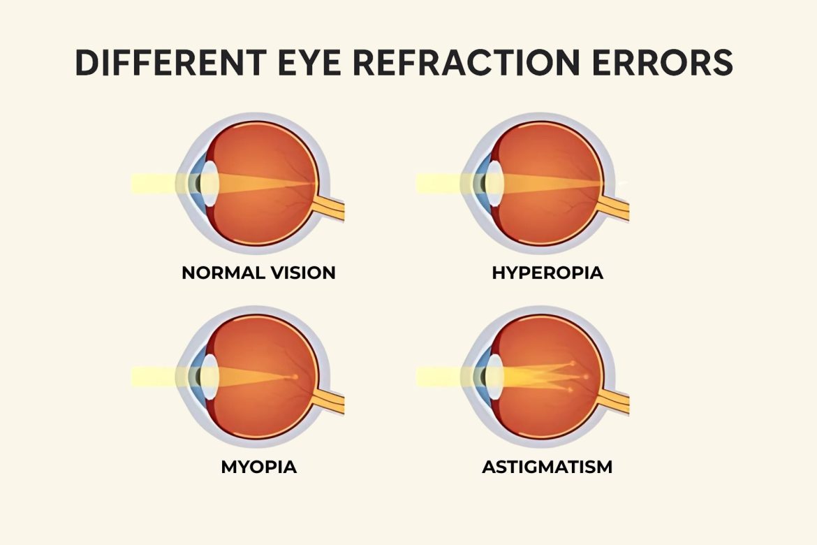 Is 20/40 Vision Bad? | EZOnTheEyes