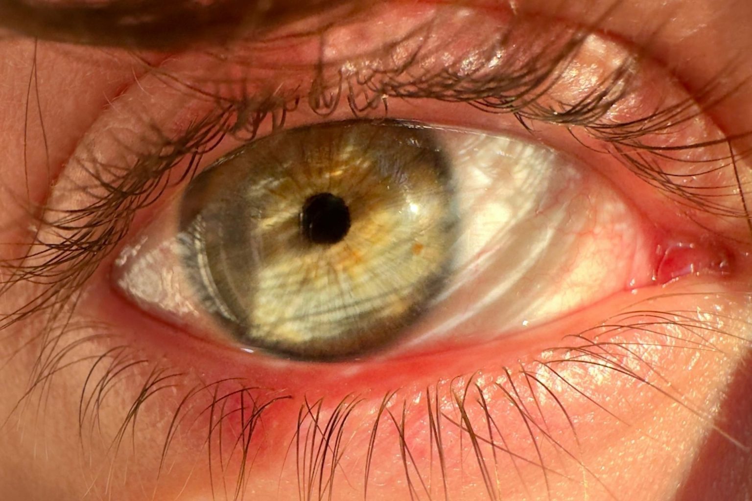 What Are Hazel Eyes? Learn All About This Rare Eye Color | EZOnTheEyes