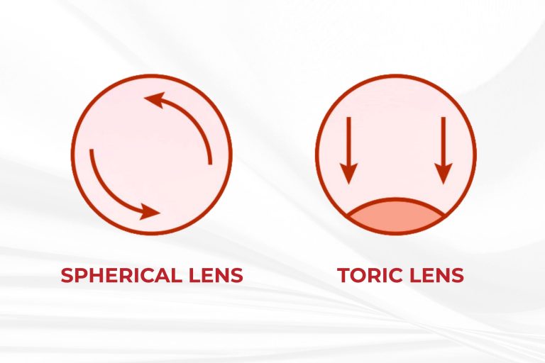 What Are Toric Contact Lenses? | EZOnTheEyes